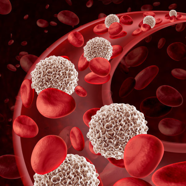 Ozone Autohemotherapy 101: Everything You Need to Know